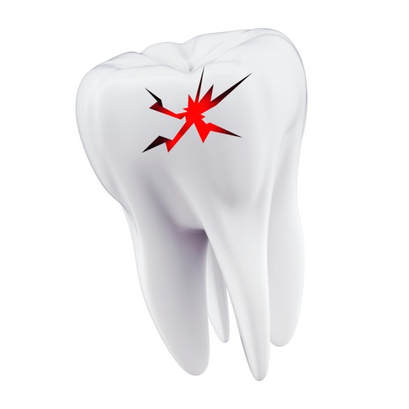 Burning Mouth Syndrome & Your Teeth | A Burning Journey